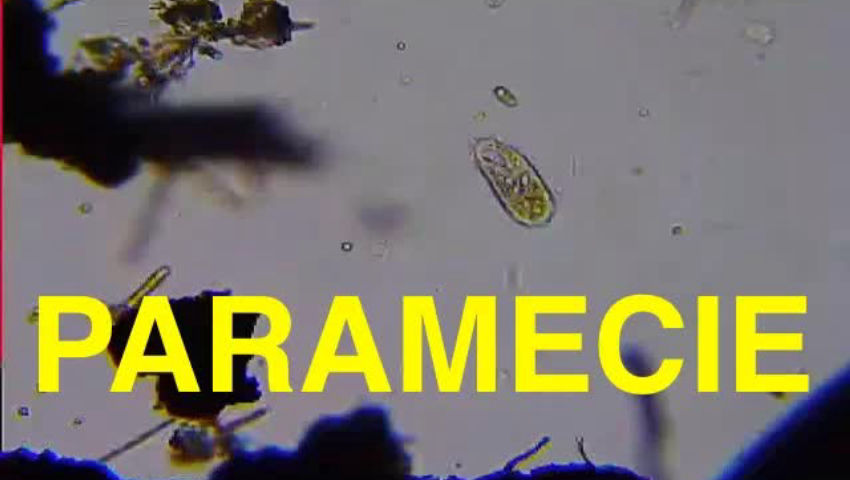 3ème - La paramécie (Microscope x170) - Sciences & Technologies