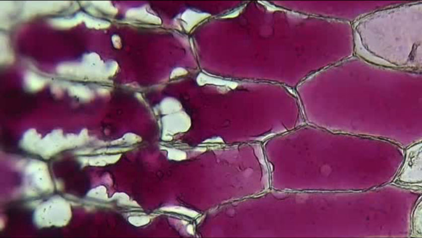 De la turgescence à la plasmolyse. Vidéo de cellules d'oignon rouge au ...